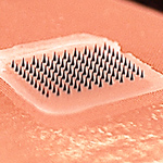 Laboratory for Drug Delivery - Microneedle Gallery